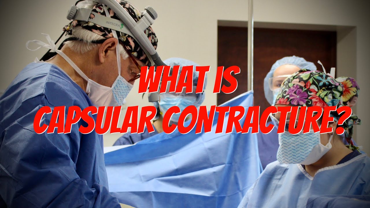 What is Capsular Contracture after Breast Augmentation? - YouTube