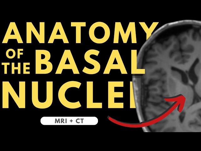 Basal Ganglia Mri