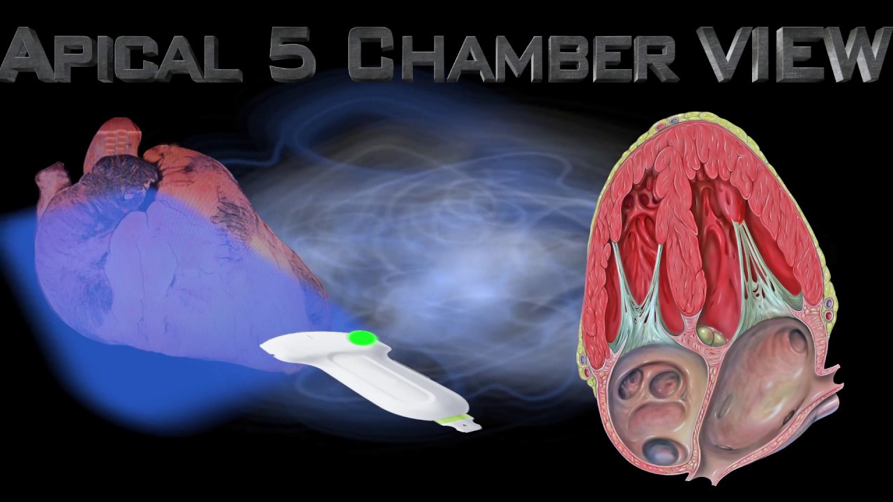- Normal ECHO cardiography views - - YouTube