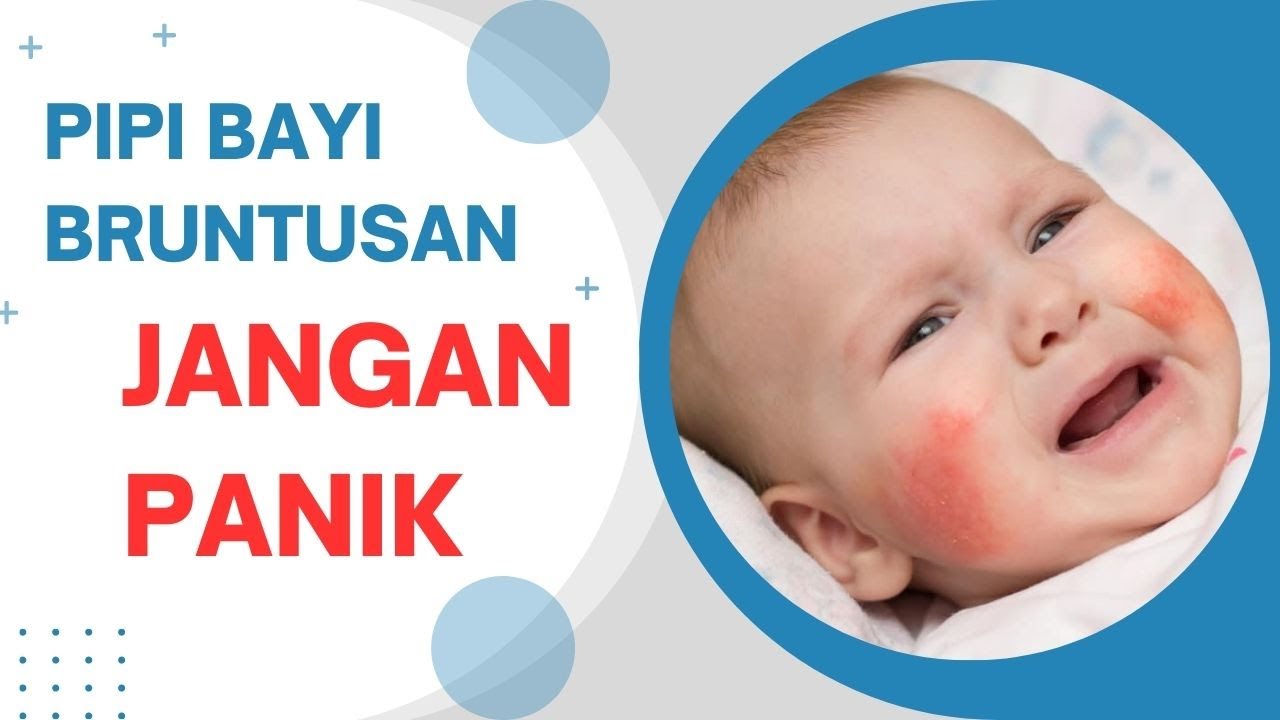 Pipi Bayi Bruntusan? Simak Penyebabnya Ini - YouTube