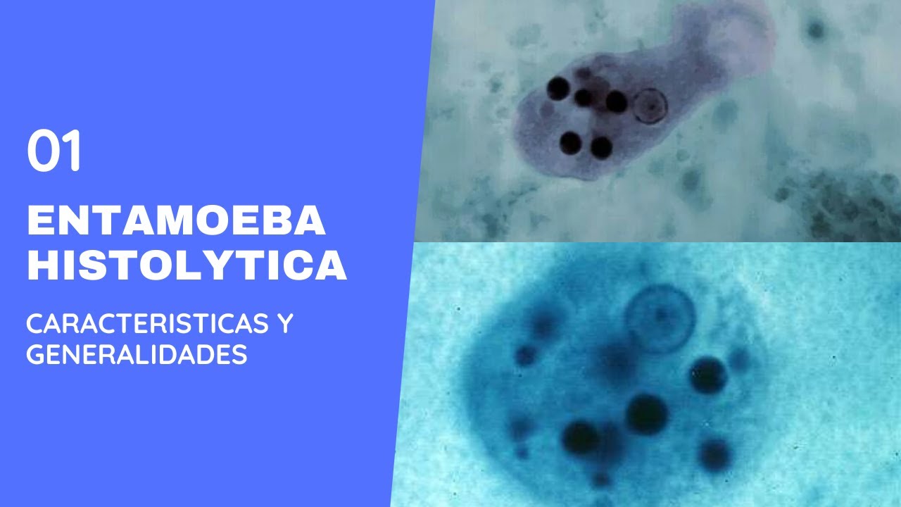 Entamoeba Histolytica 1.0 ||Parasitolgia || Amebas || Amebiasis ...