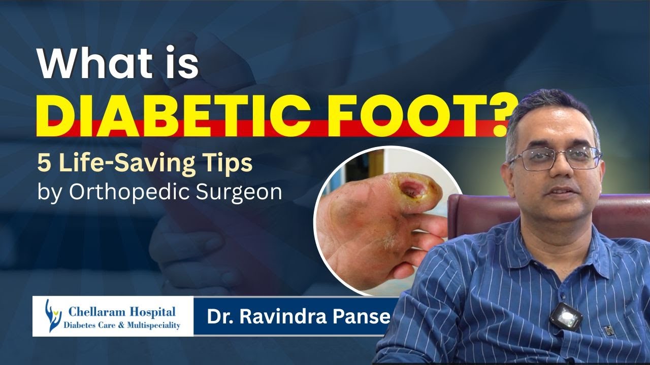What is Diabetic Foot? 5 Life-Saving Tips by Dr. Orthopedic Surgeon | Chellaram Hospital - YouTube
