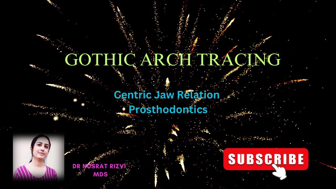 Gothic Arch Tracing / Centric Jaw Relation / Prosthodontics - YouTube