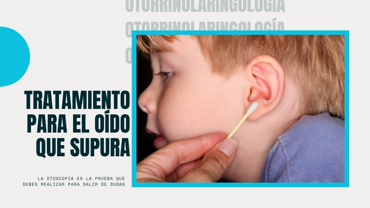 Tratamiento de la Otitis, ¡oído que supura constantemente! - YouTube
