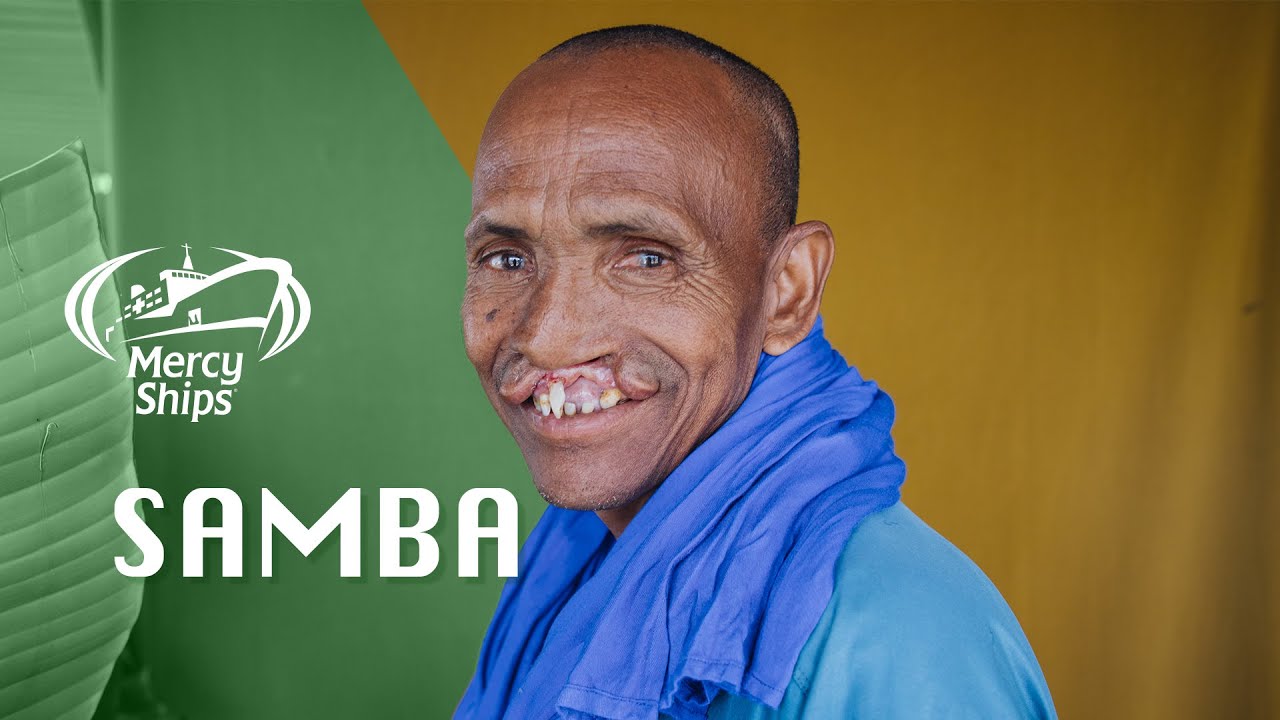 Samba werd na 56 jaar geopereerd aan zijn gespleten lip - YouTube