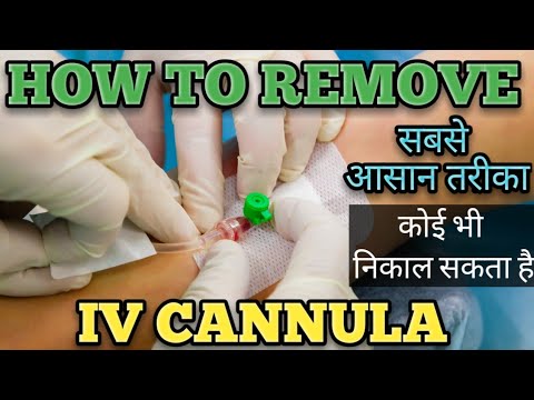 iv cannula कैसे निकालते हैं ll how to remove iv cannula - YouTube
