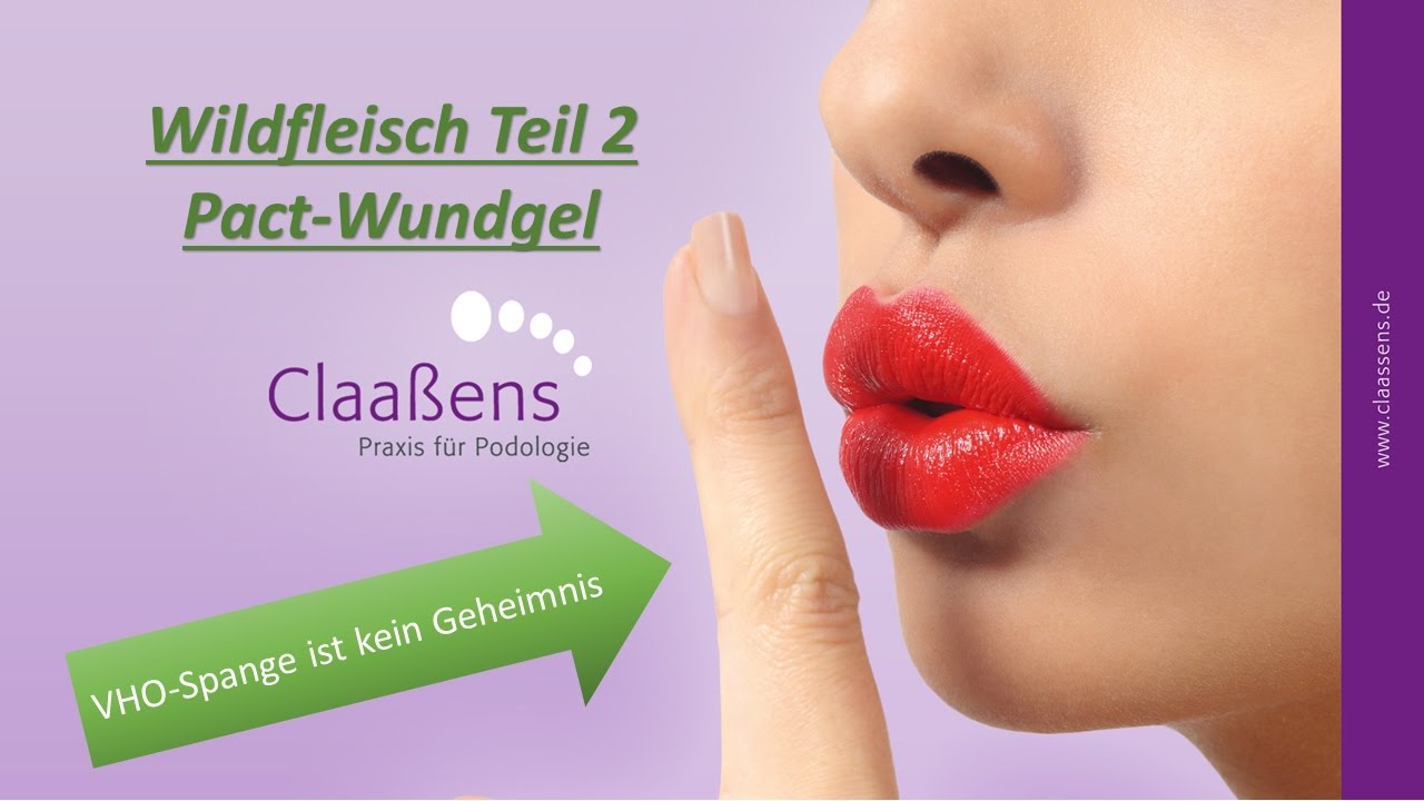 Wildes Fleisch Im Nagelbett? _ Nagelentzündung » wann muss operiert ...