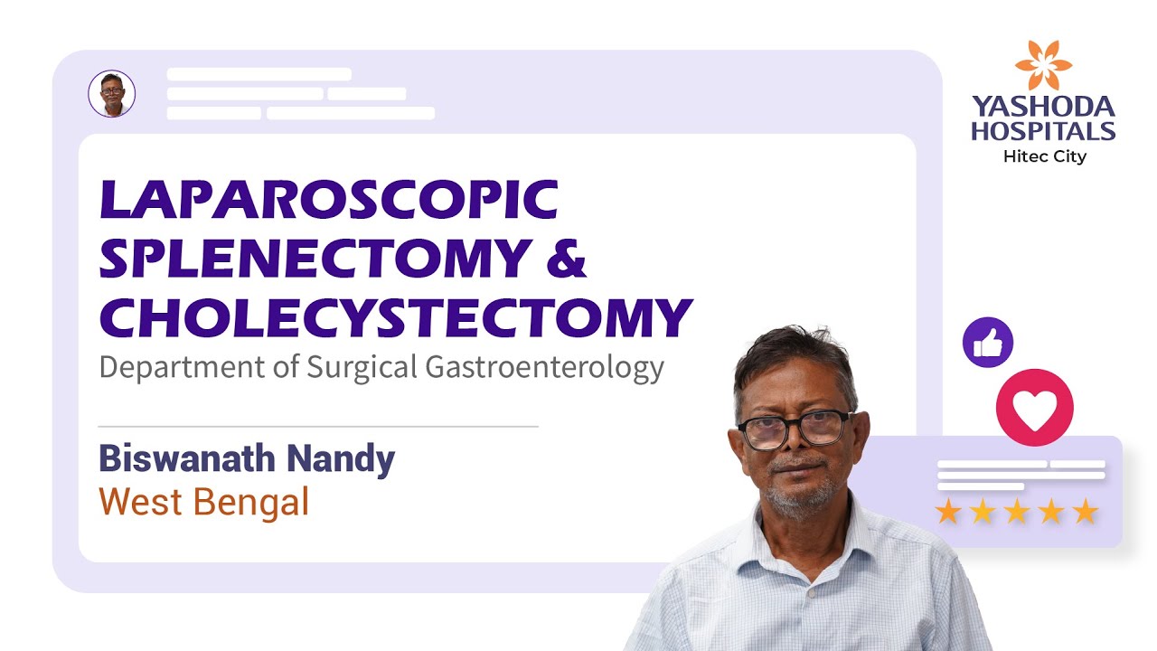 Laparoscopic Splenectomy & Cholecystectomy | Yashoda Hospitals ...