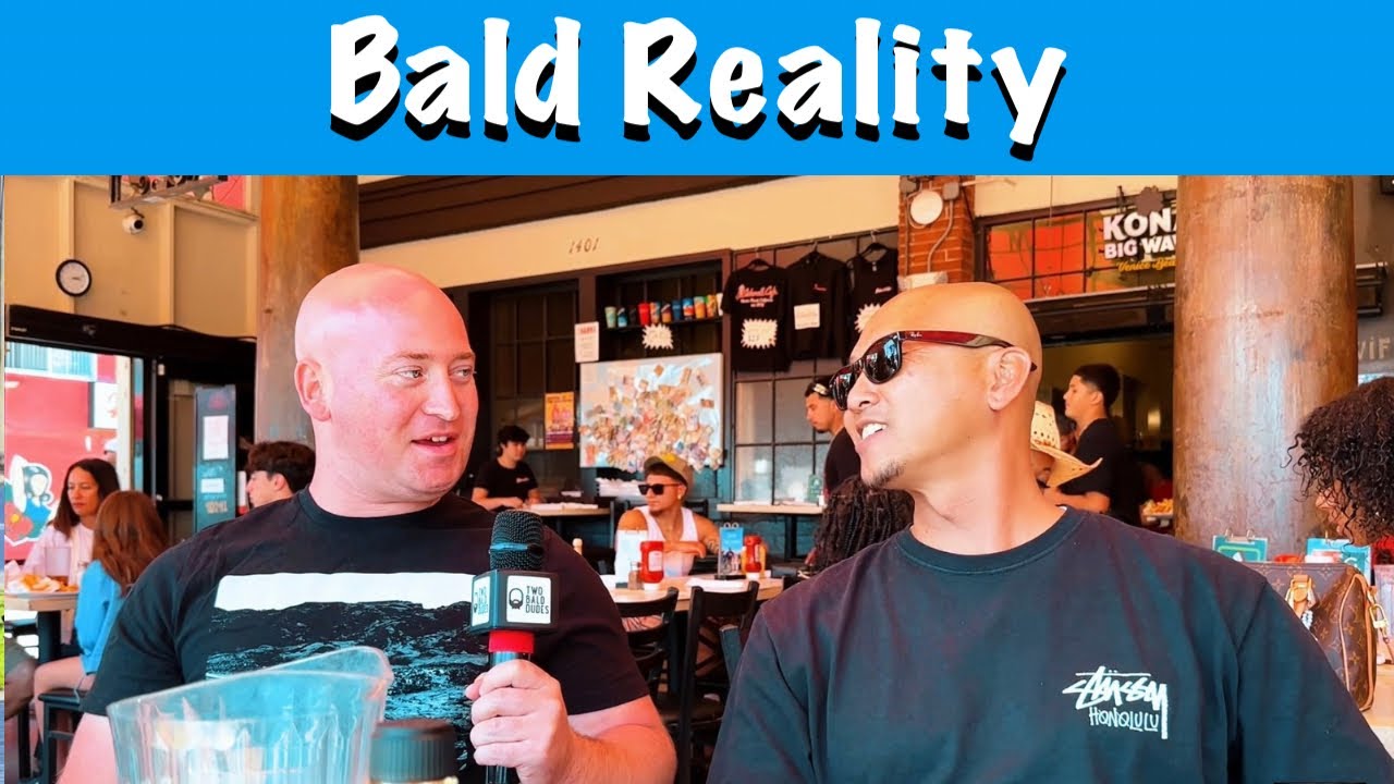 The Truth About Being Bald | Ep. 21 - YouTube