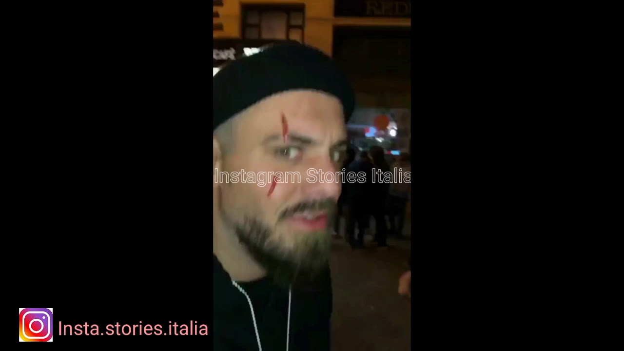 TONY EFFE MOSTRA UN TATUAGGIO DOLOROSISSIMO IN FACCIA!!! - YouTube