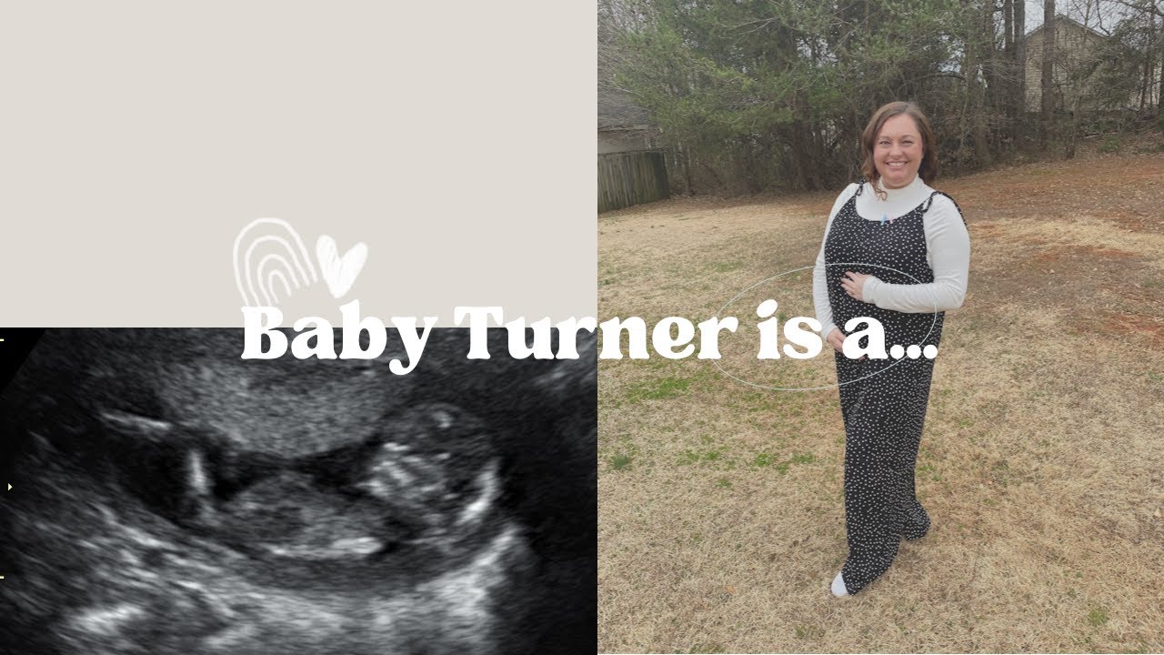 Baby Turner Is A... - YouTube