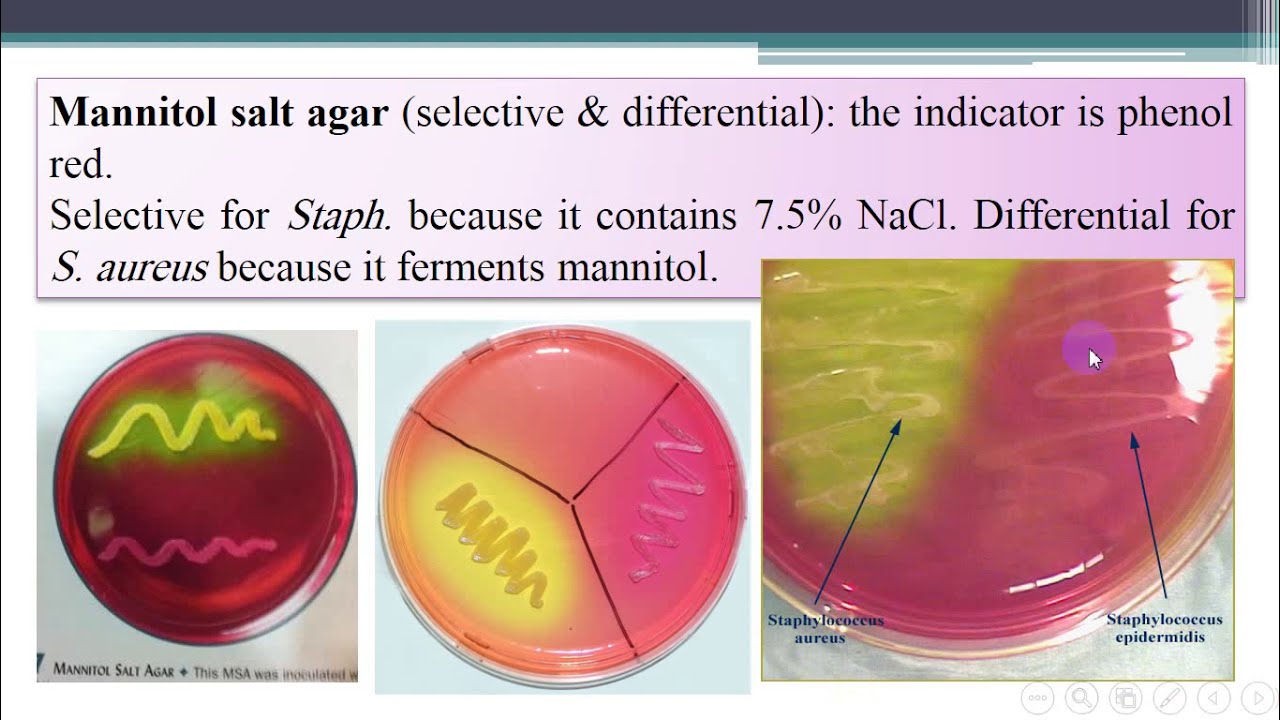 Pathogenic bacteria Lab 7 Staphylococcus Spp - YouTube