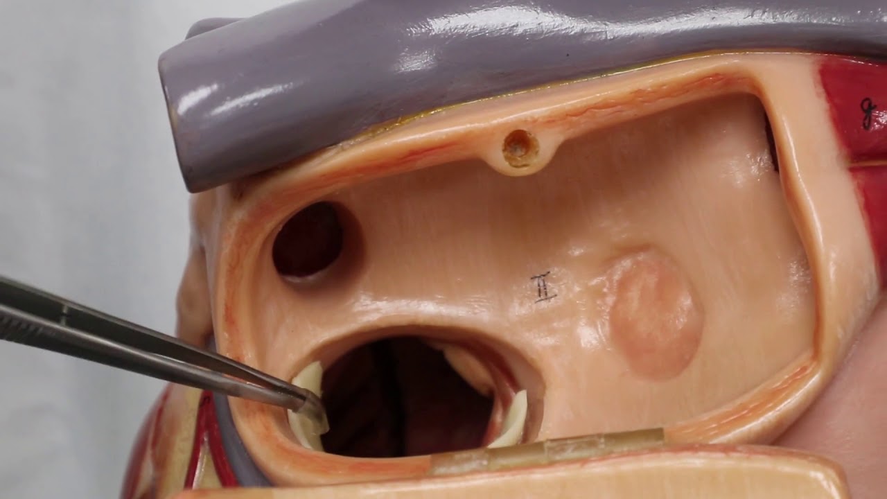 Internal Feature of Left Atrium - YouTube