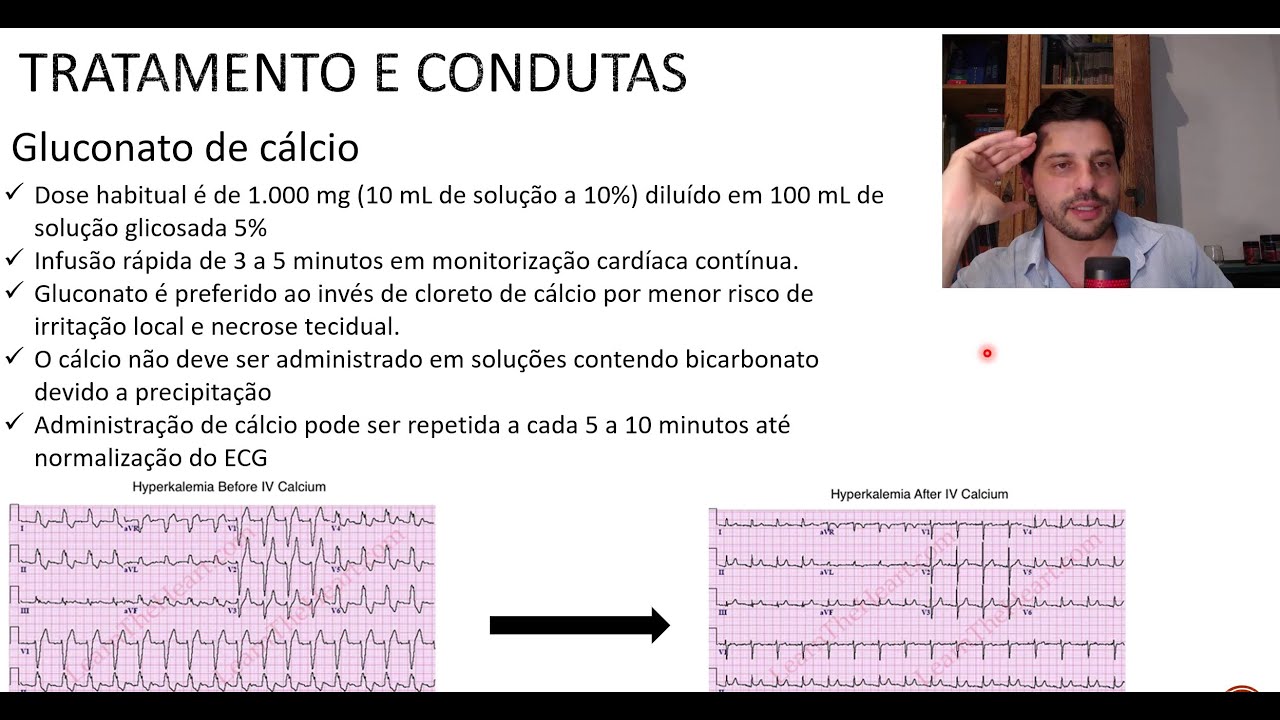 Aula Hipercalemia/ Hiperpotassemia - YouTube