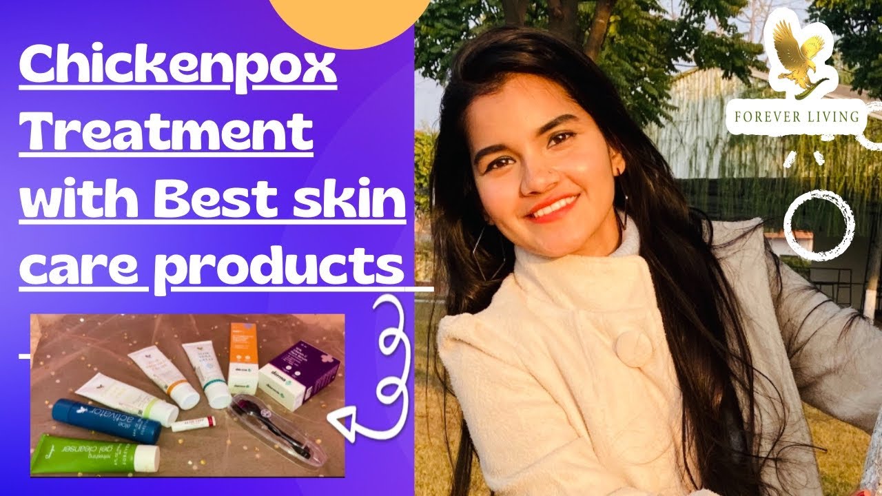 My Chickenpox treatment | Best skincare products | Forever living - YouTube