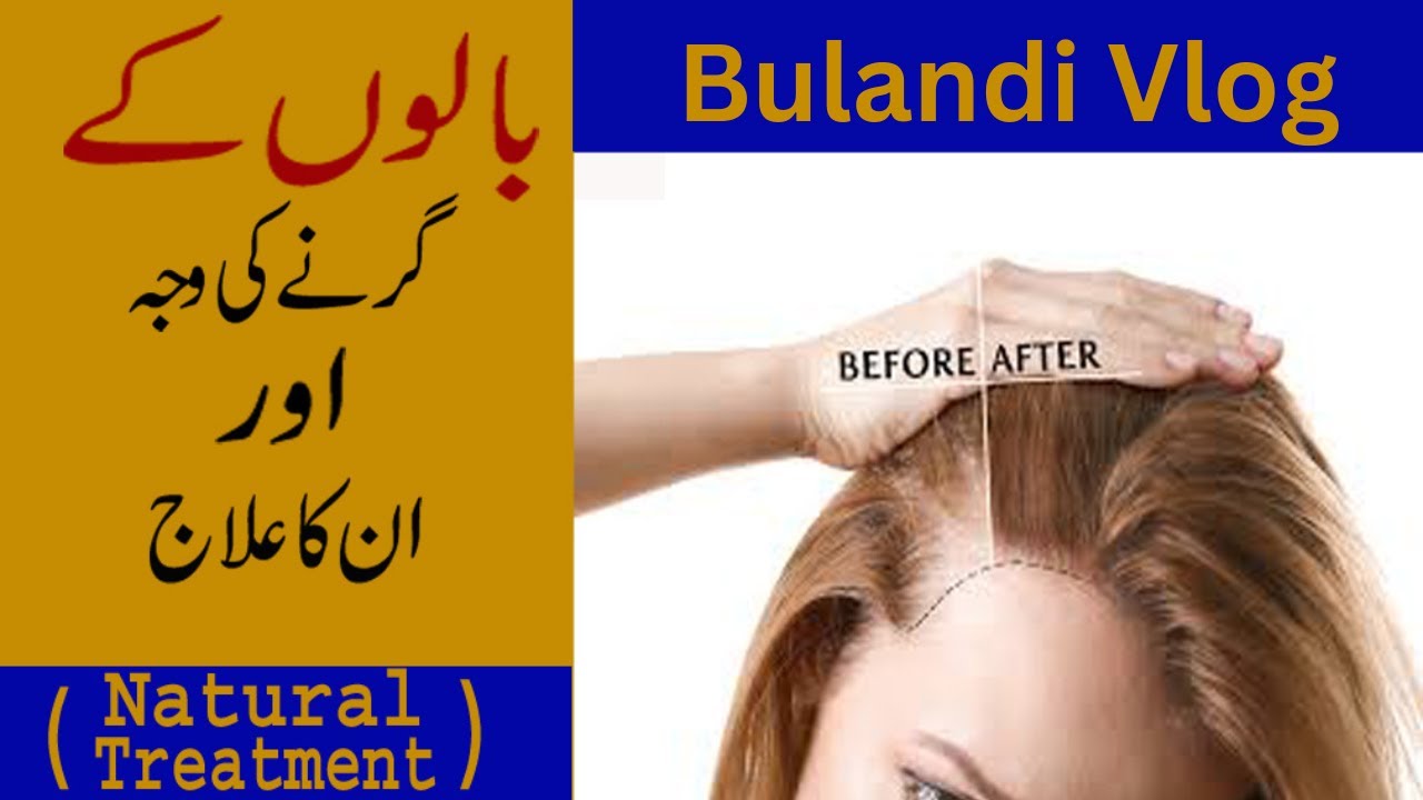 Hair Loss Treatment For Men And Women How To Stop Hair Loss