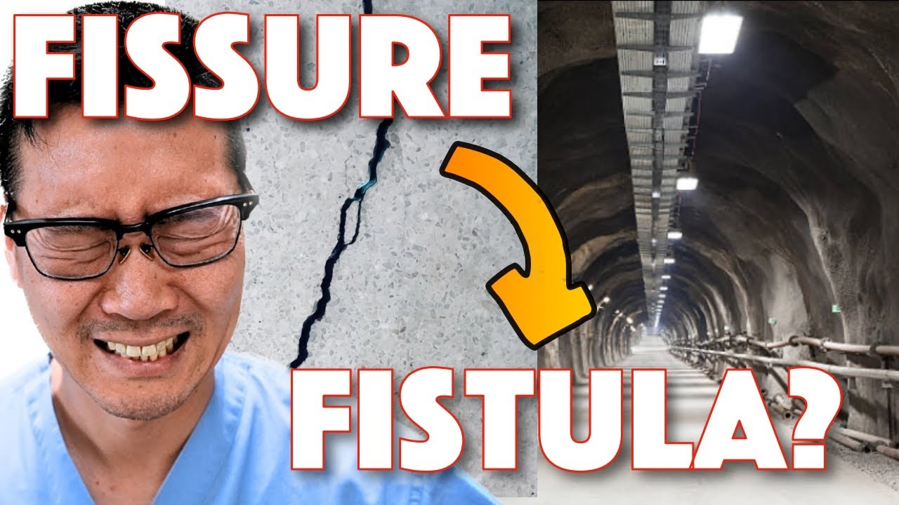 Has your FISSURE become a FISTULA? - YouTube
