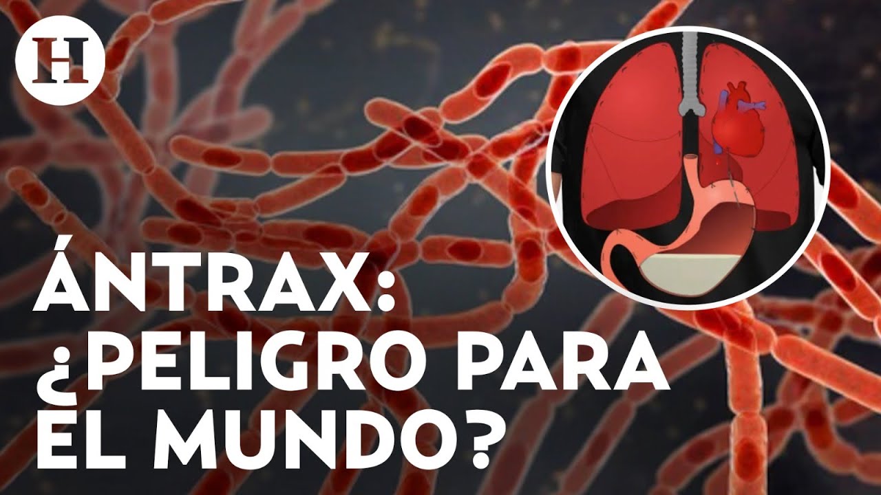 Alerta por brote de Ántrax en África enciende alarmas; así se contagia ...
