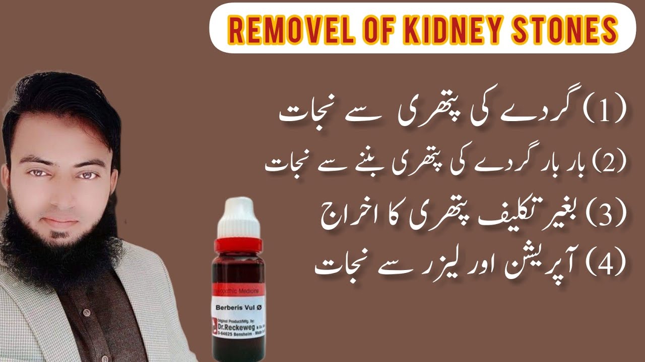 Removel of Kidney stones || homeopathic medicine for kidney stones ...