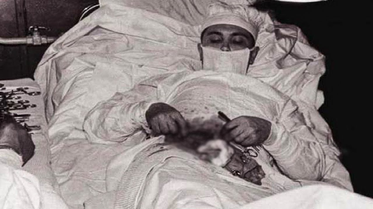 During The Expedition, He Performed An Operation To Remove The Appendix ...