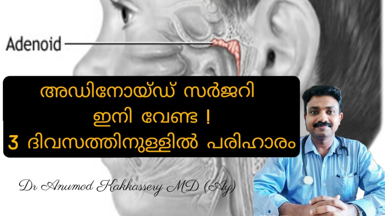 Adenoid Ayurveda treatment| Adenoid without surgery/ How to avoid ...