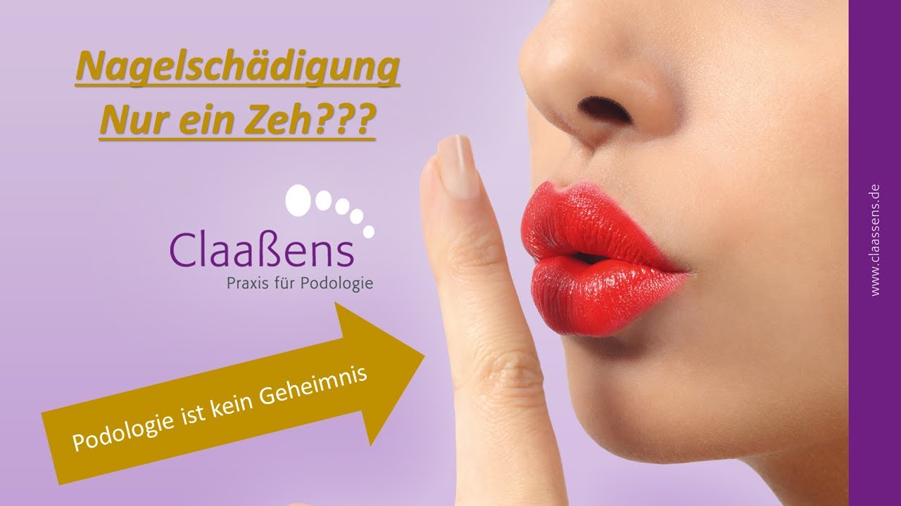 Nur ein Zeh????? - YouTube