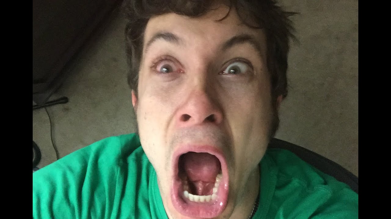 DISGUSTING RED EYE!! - YouTube