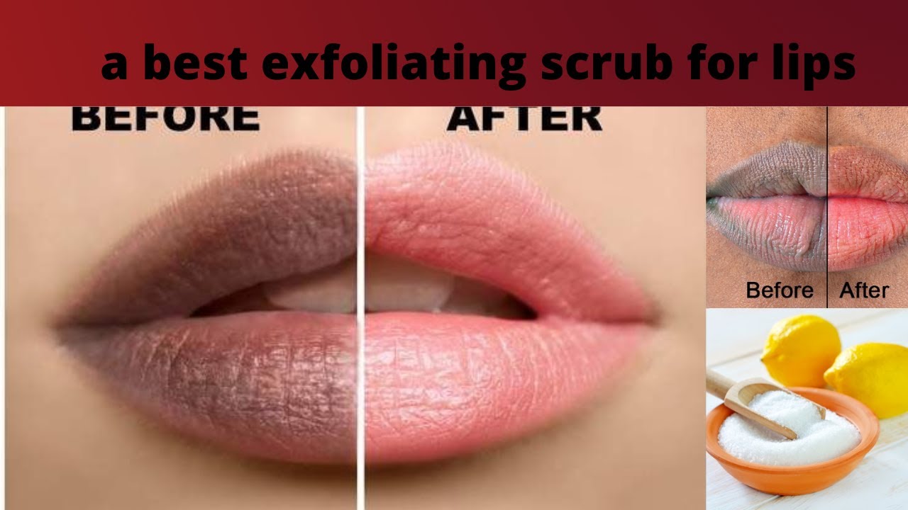 How To Get A Pink Lips Naturally | Remove Pigmentation of Lips|lip ...