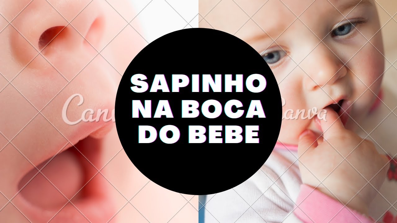 Sapinho na boca do bebe - YouTube