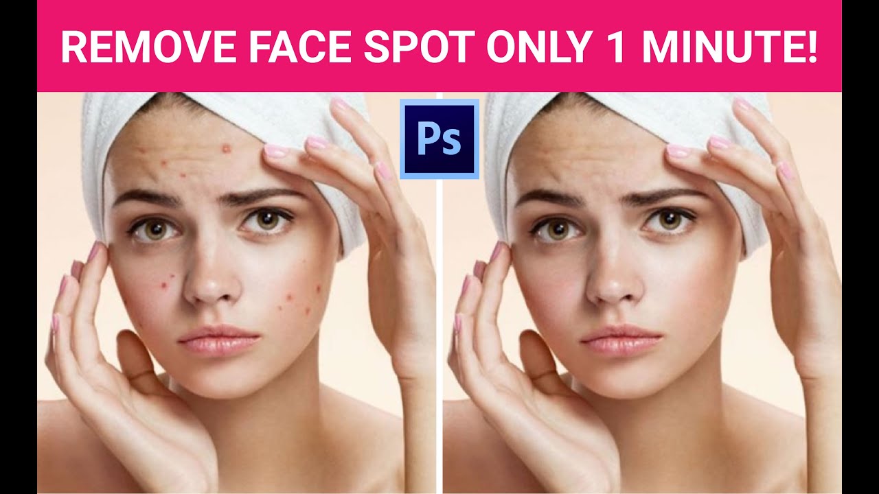 How To Quickly Smooth Skin And Remove Dark Spots Remove Face Spots In Photoshop YouTube how-to-quickly-smooth-skin-and-remove-dark-spots-remove-face-spots-in-photoshop-youtube