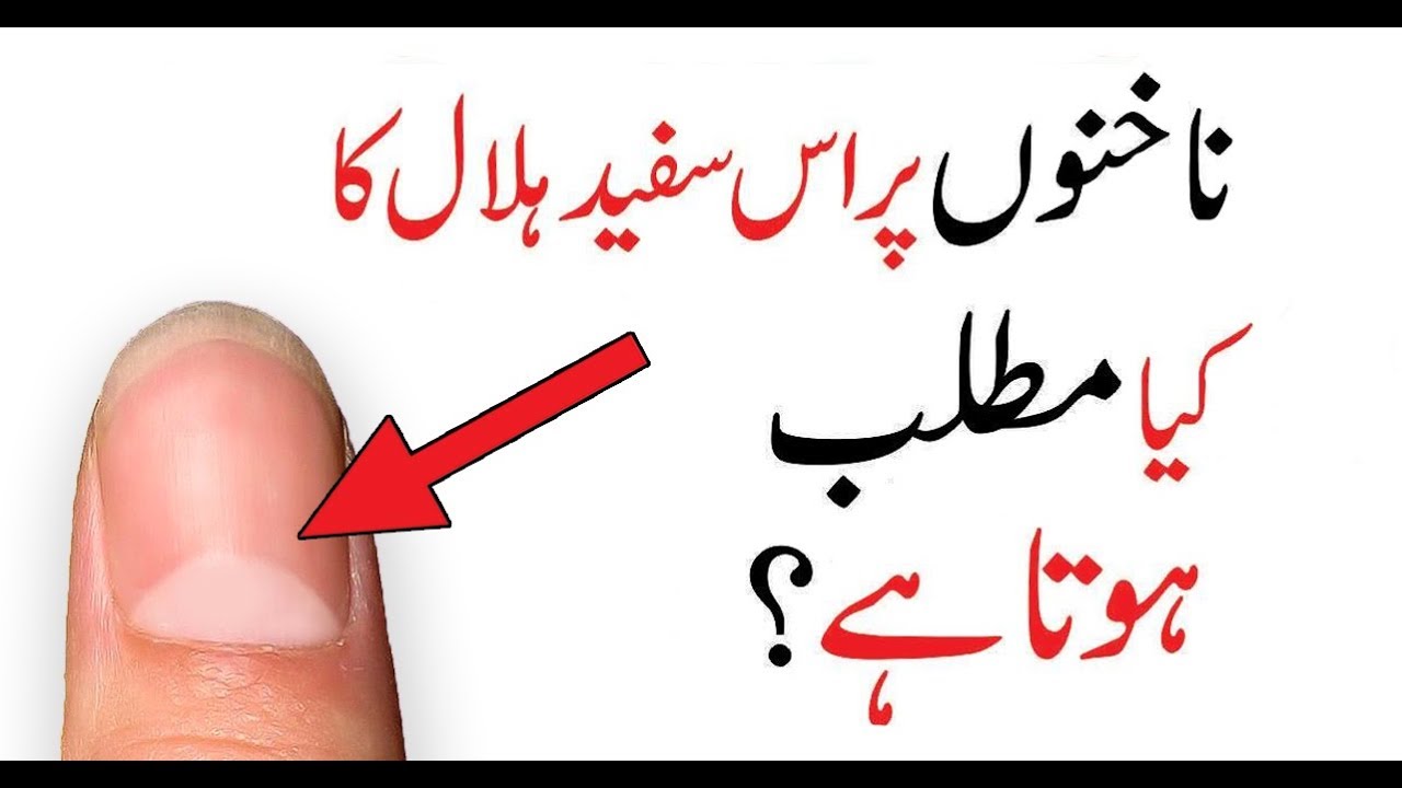 White Spots On Nails White Marks On Nails white-spots-on-nails-white-marks-on-nails