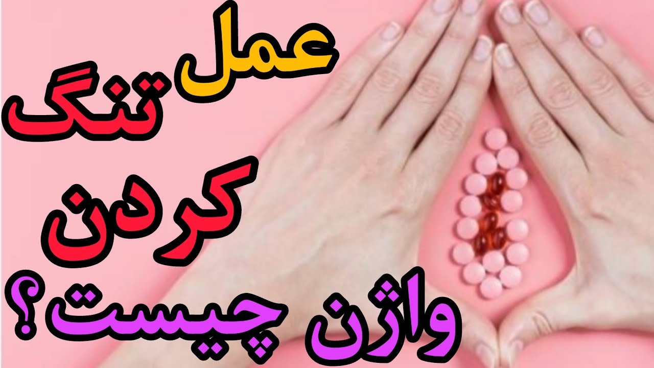تنگ کردن واژن یا واژینوپلاستی چیست همه چیز درباره عمل تنگ کردن واژن