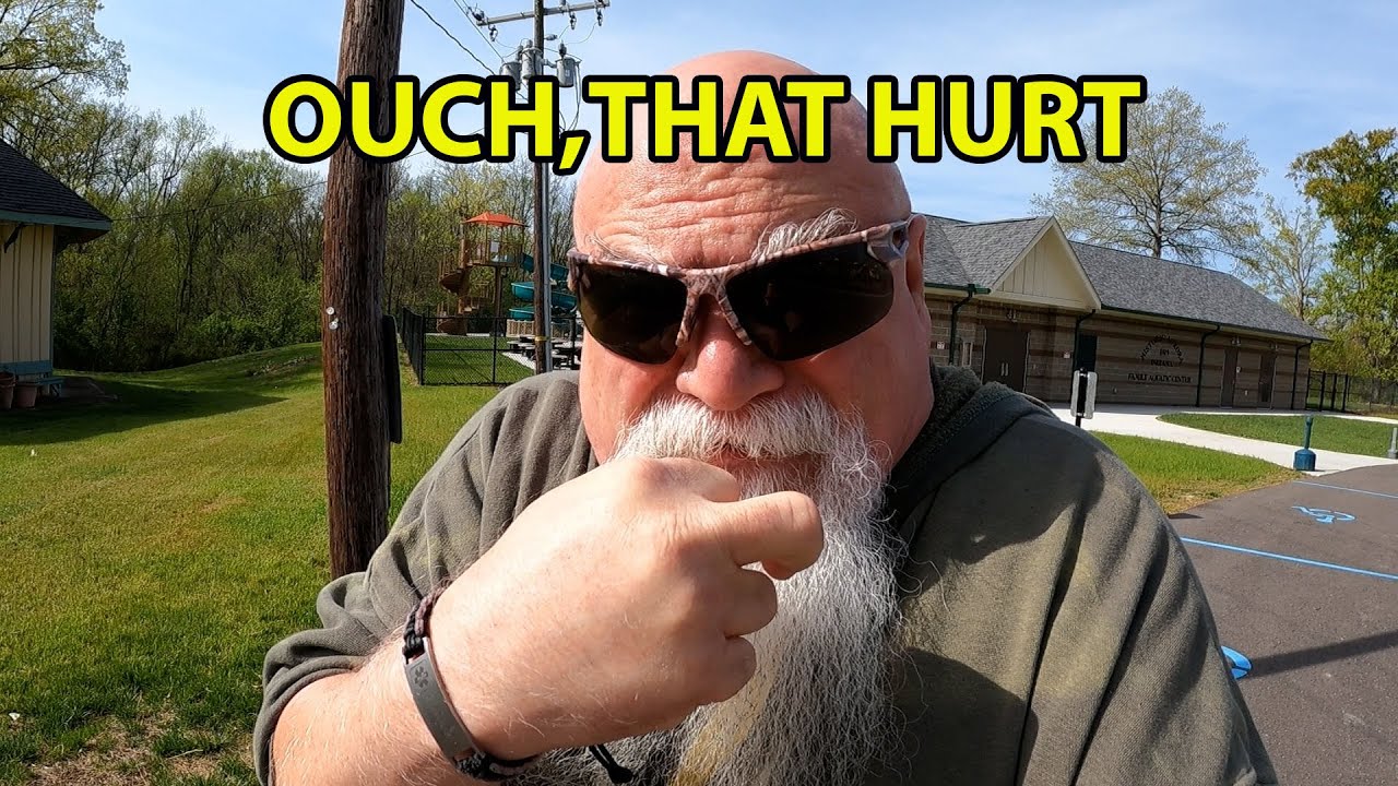 I Smashed my Finger - YouTube