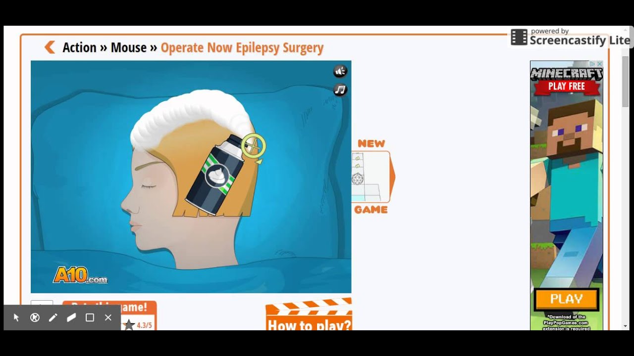 BRAIN!!! Operate Now! Epilepsy Surgery Ep.1 - YouTube