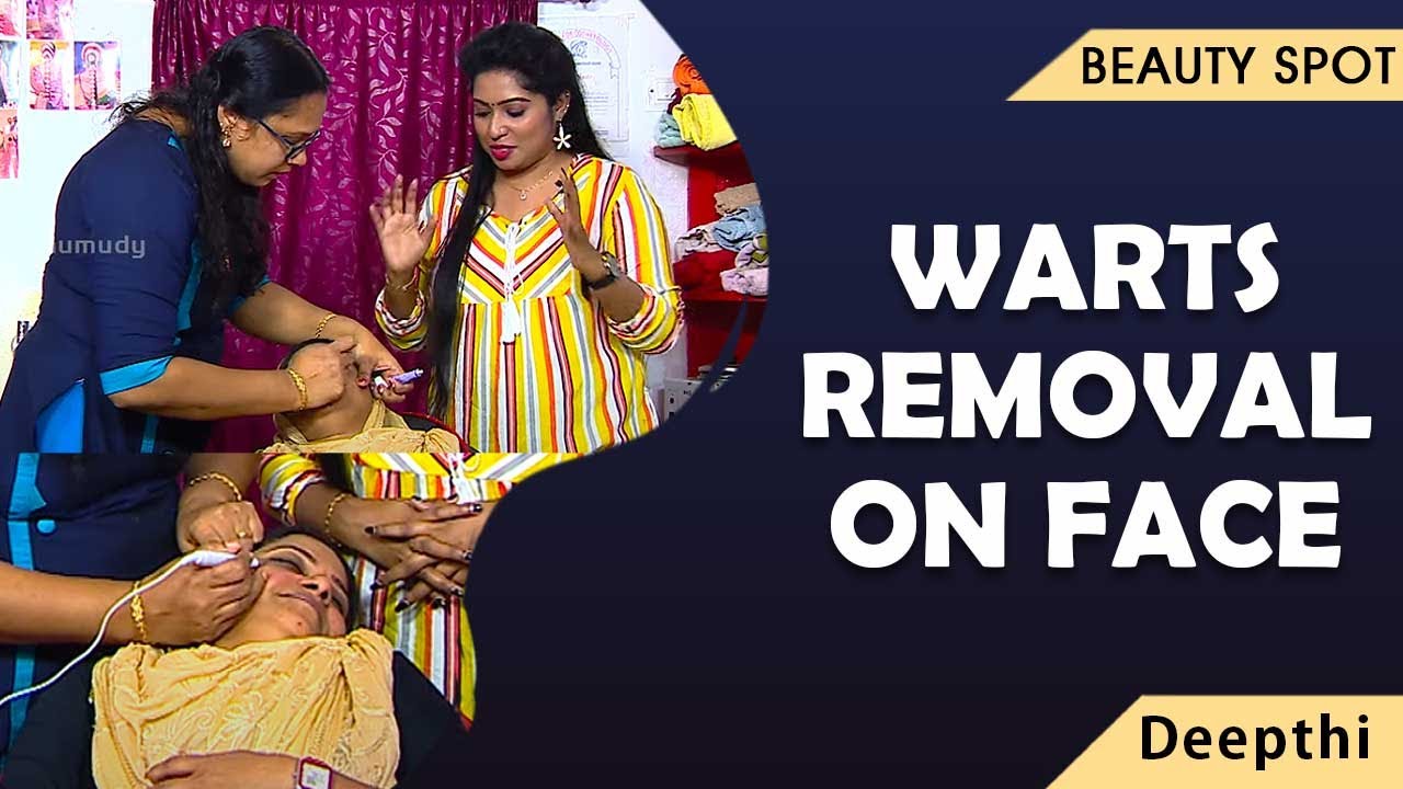 Warts Removal on face | Prevention and Treatment | Beauty | Kaumudy ...
