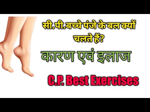 cerebral palsy best exercise, cp child stretching exercise?