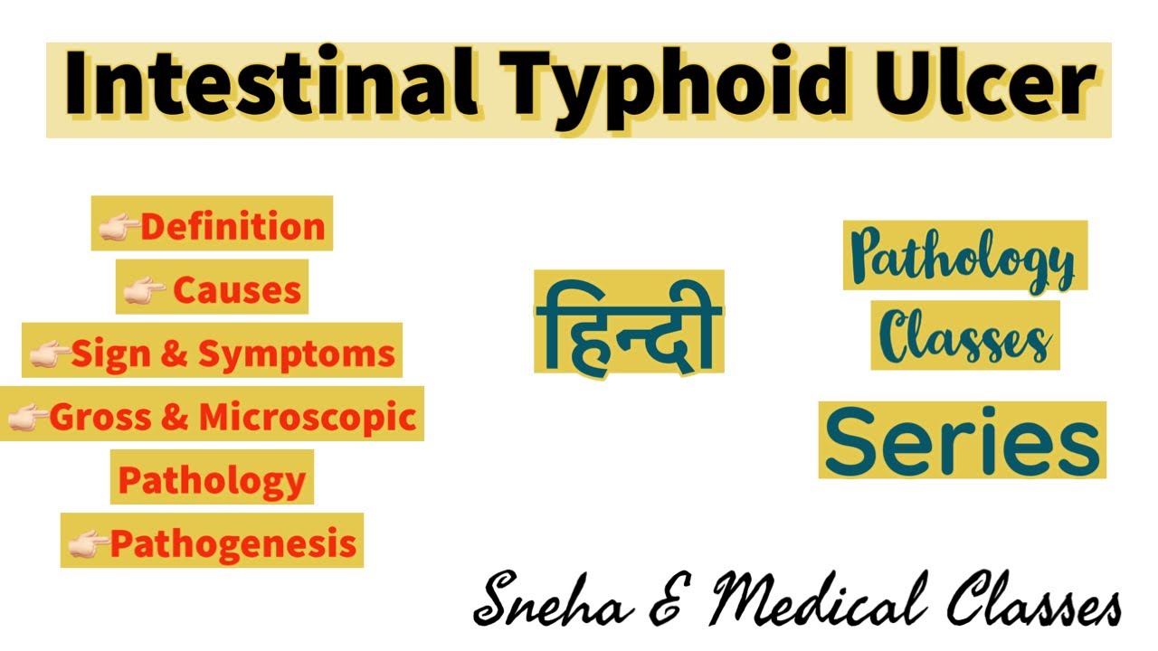 Intestinal Typhoid Ulcer Pathology !! - YouTube