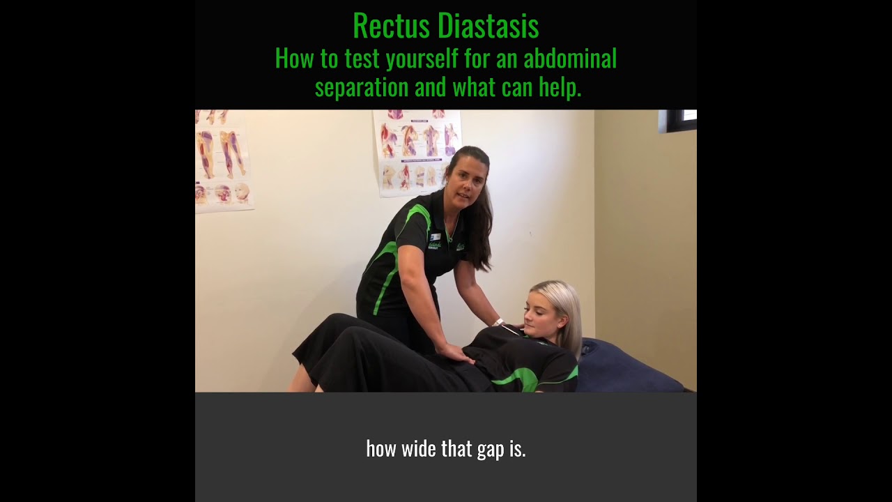 Rectus Abdominal Separation: How to test yourself and why you need to ...