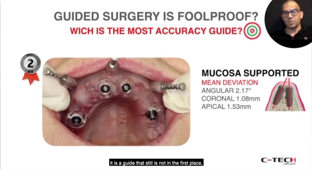 Digital Implant Planning & Guided implant surgery.Work-flow and tips to ...