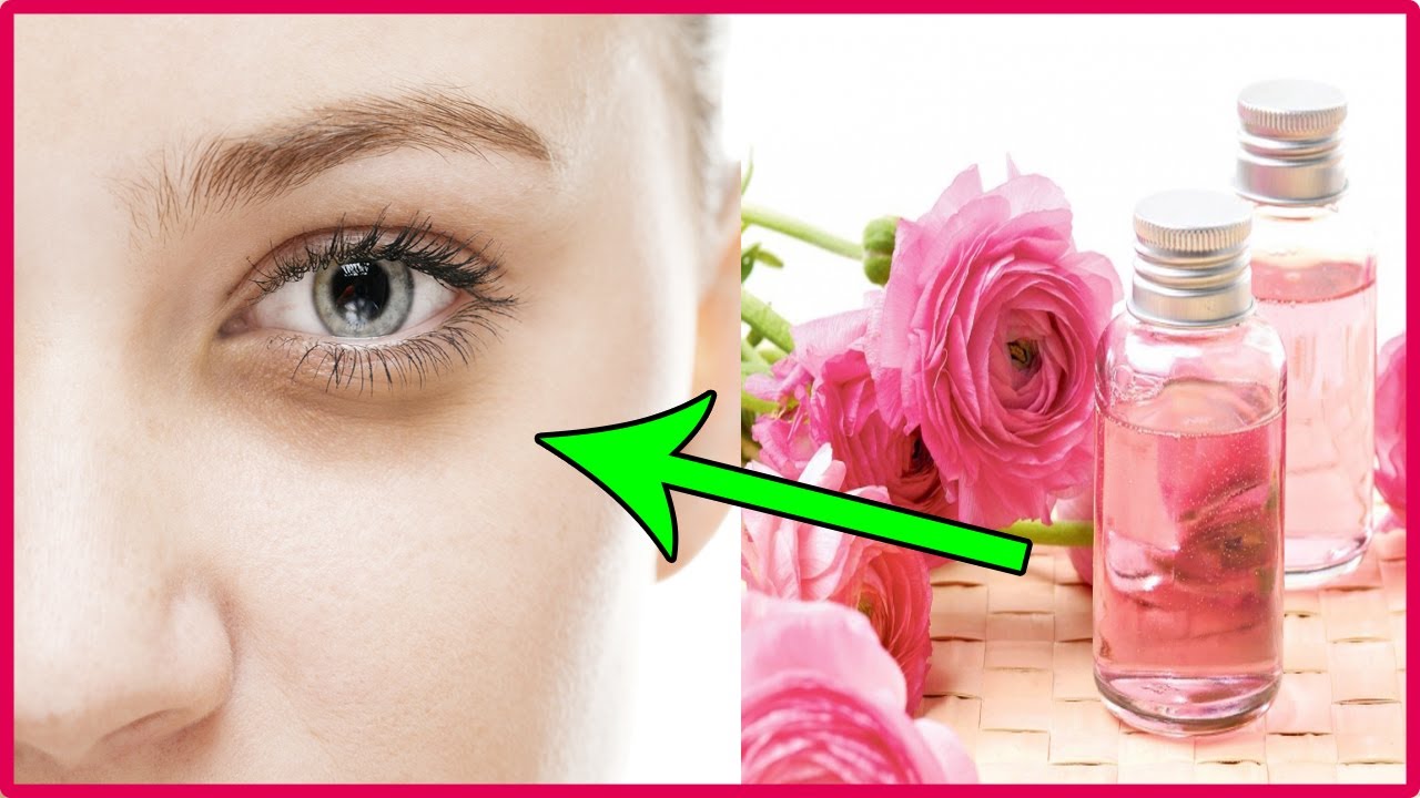How To Get Rid Of Dark Circles Naturally In 2 Days Remove Dark how-to-get-rid-of-dark-circles-naturally-in-2-days-remove-dark