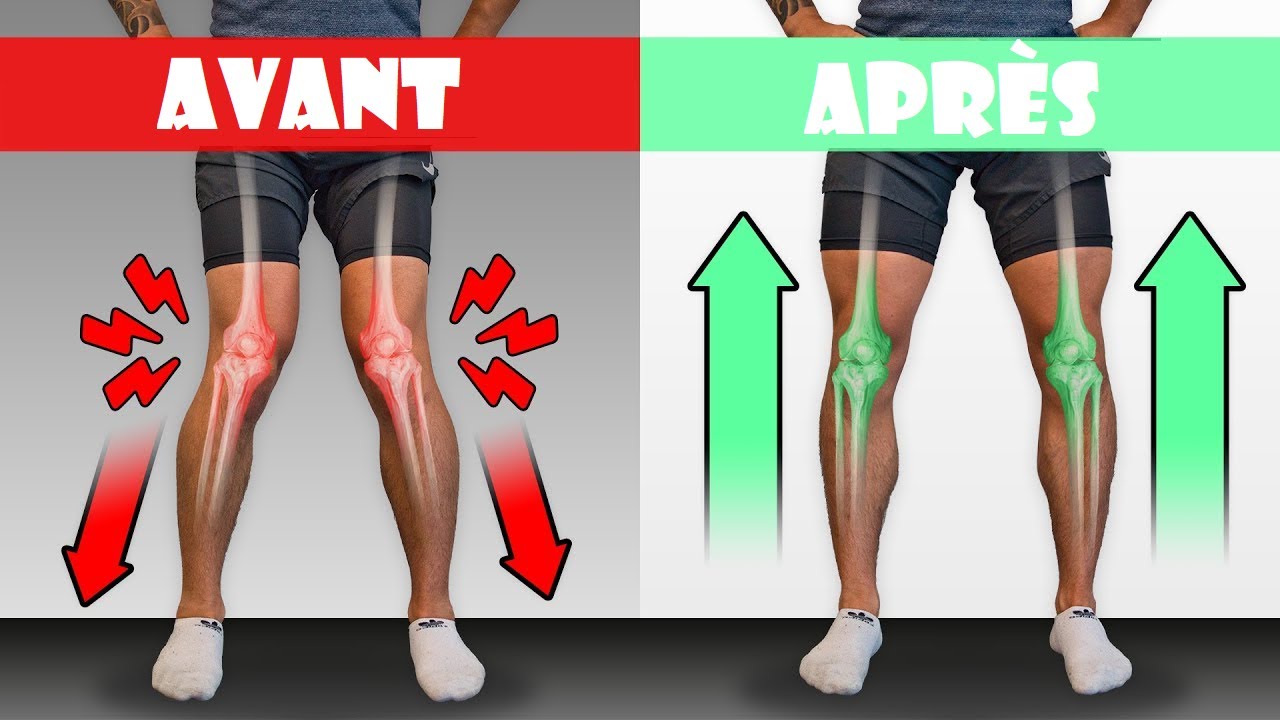 10 Exercices qui Corrigent le Valgus du Genou - YouTube