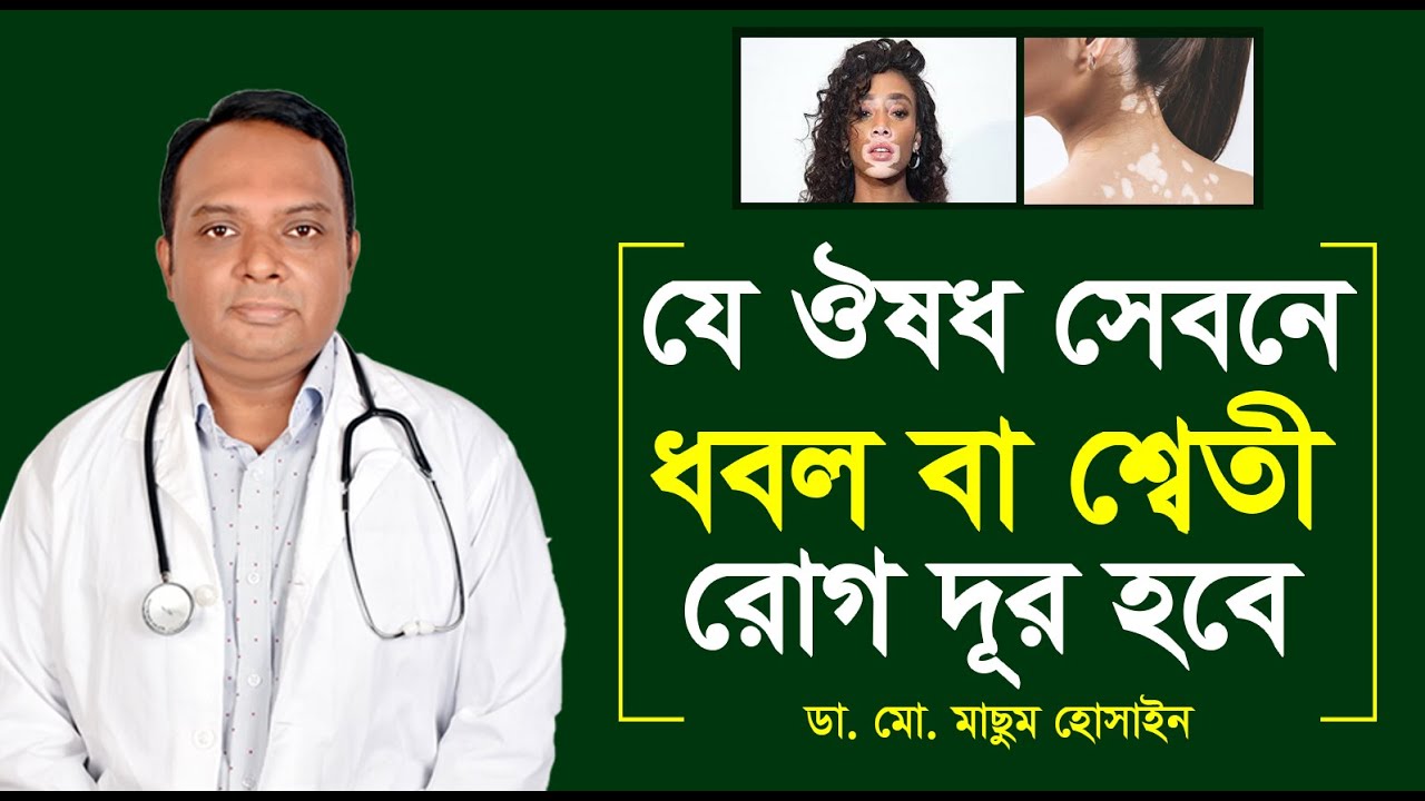 শ্বেতী বা ধবল রোগ থেকে বাঁচতে এই ভিডিওটি অবশ্যই দেখবেন Dr. Masum ...