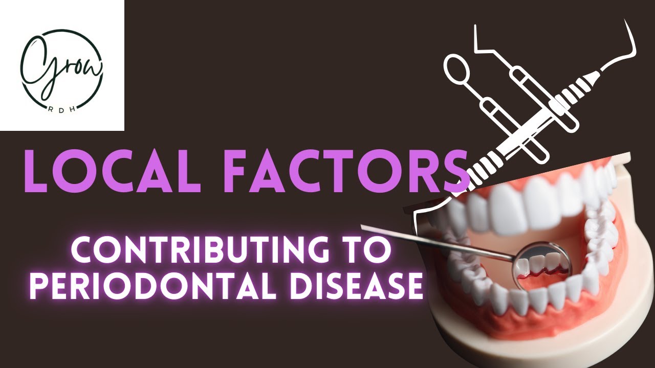 Local Factors Contributing to Periodontal Disease - YouTube