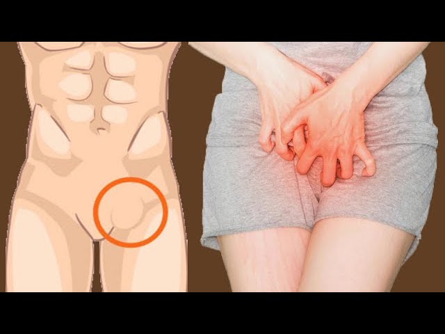 Why Are My Groin Lymph Nodes Swollen - Infoupdate.org