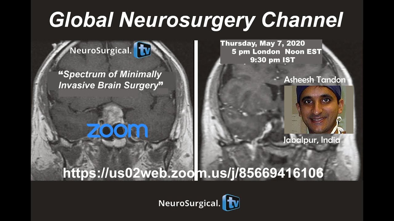 Spectrum of Minimally Invasive Brain Surgery - YouTube