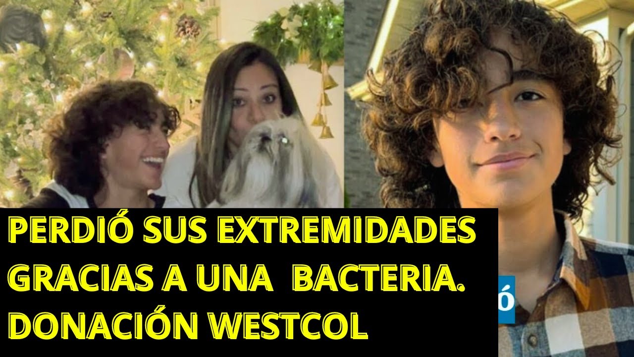 MATIAS URIBE pierde PIERNAS Y BRAZOS por una bacteria DONACIÓN WESTCOL ...