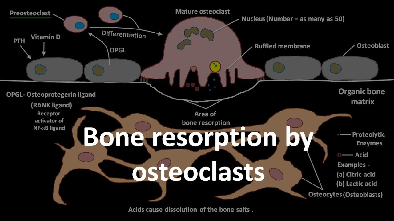 Bone Resorption By Osteoclasts YouTube Bone Resorption By Osteoclasts YouTube