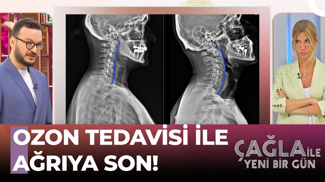 Boyun Kireçlenmesi Neden Oluşur? - Çağla ile Yeni Bir Gün 993. Bölüm ...