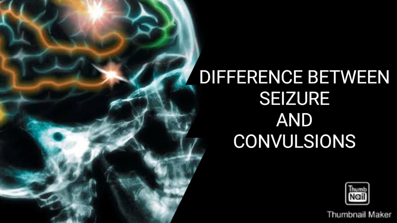 difference between seizure and convulsions |mbbs final year viva ...