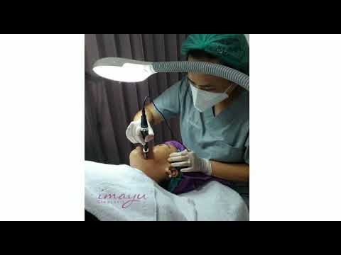DERMA GLOW DI KLINIK IMAYU CLEAR SKIN